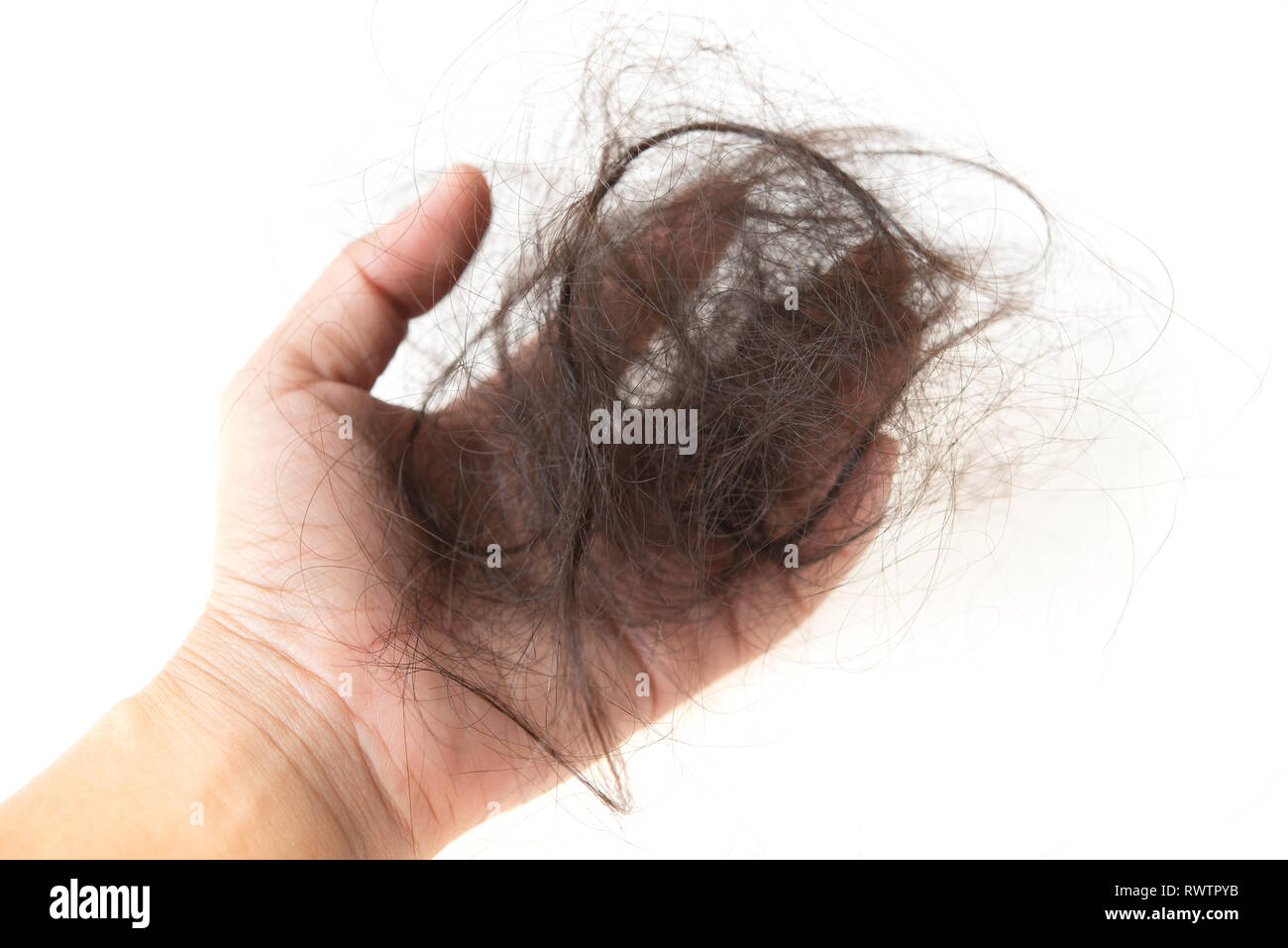 Human hand with lost hair on it, isolated on white background Stock ...