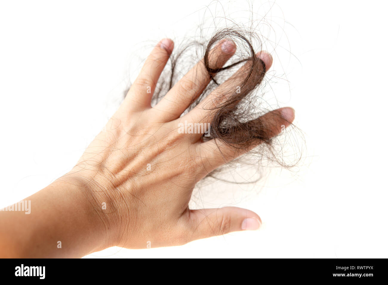 Human hand with lost hair on it, isolated on white background Stock ...