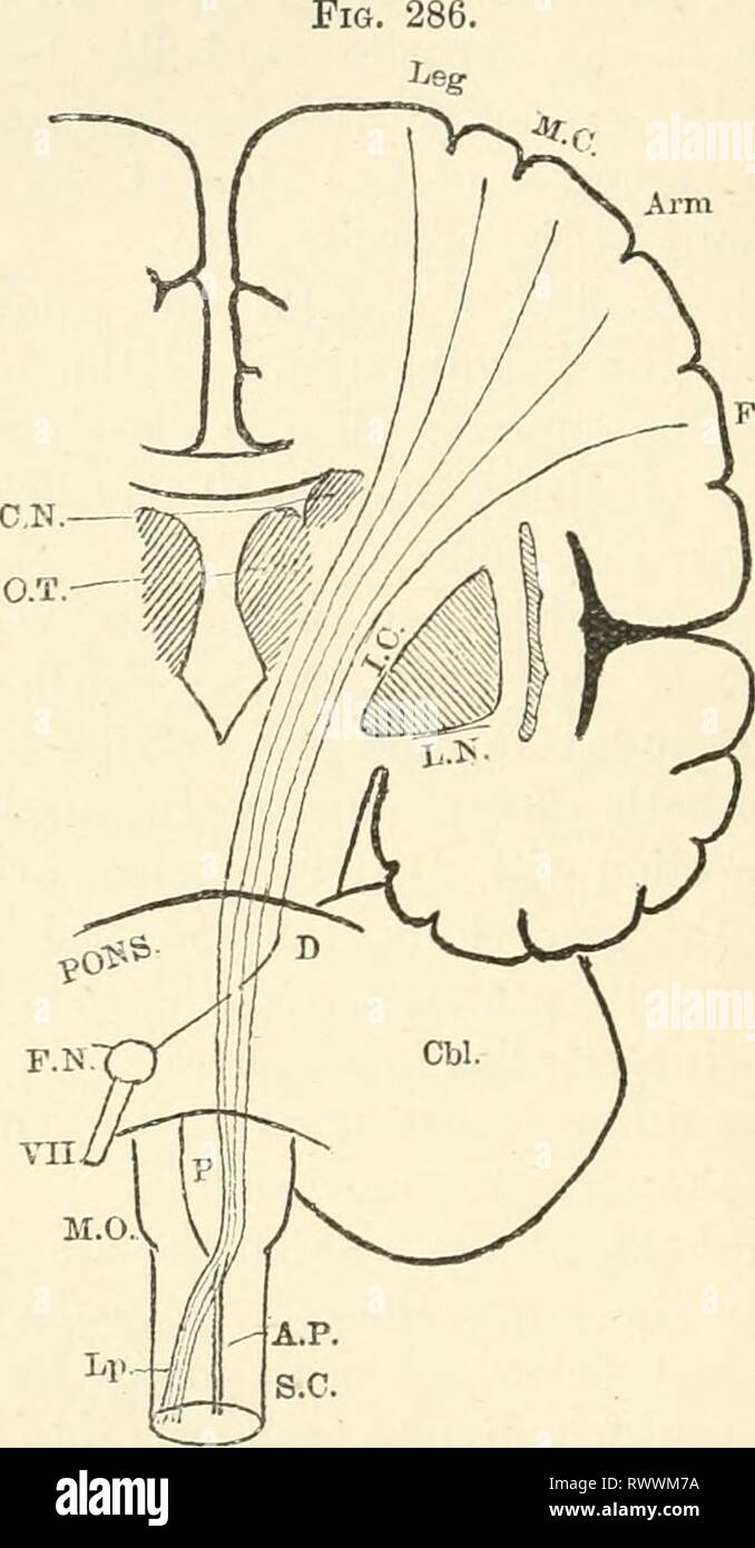 Cerebral cortex operation hi-res stock photography and images - Alamy
