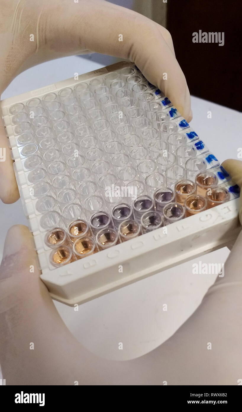 scientific hands holding a micro-plate, investigating the cure Stock ...