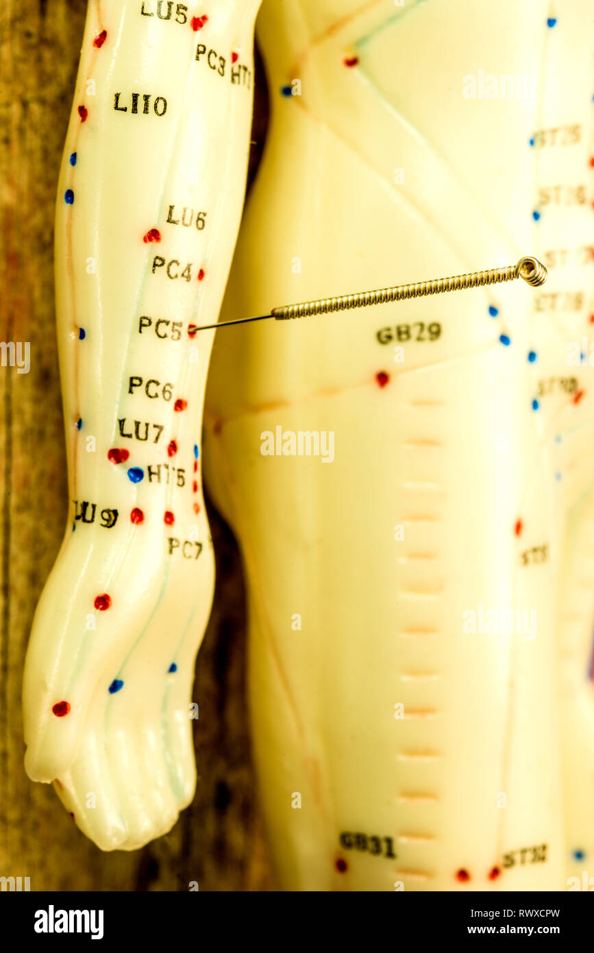 acupuncture demonstration on model Stock Photo - Alamy