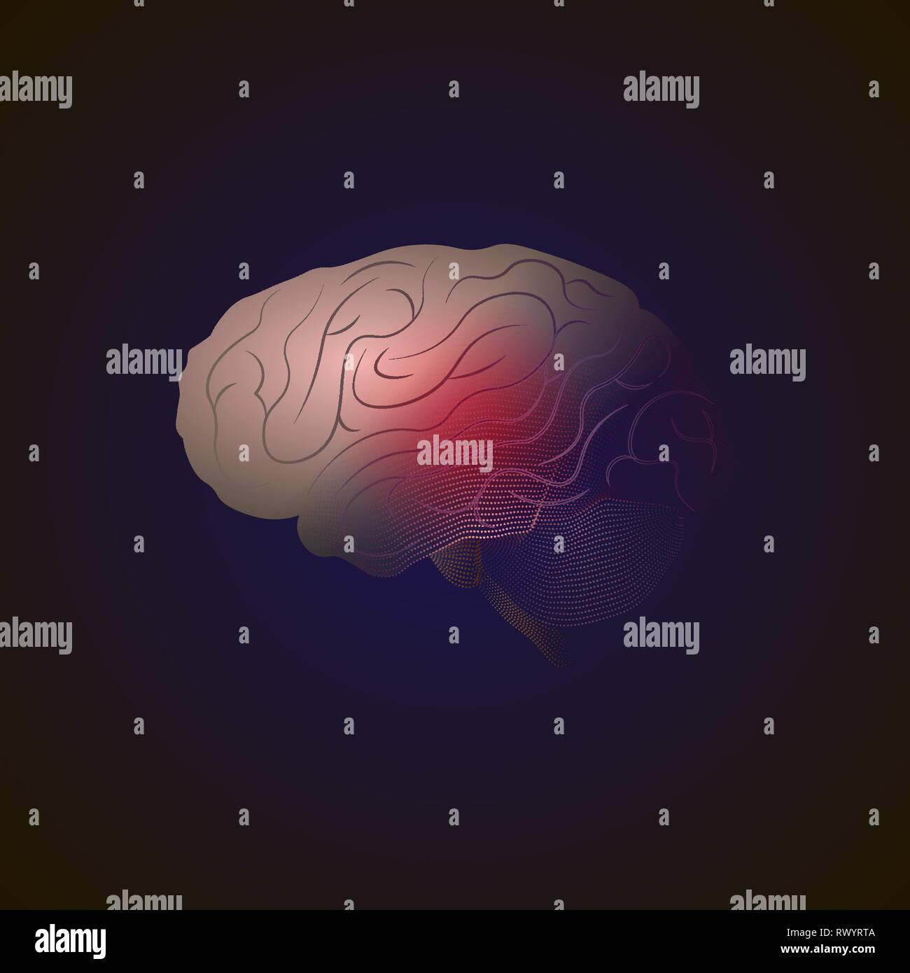 Transition from real to x-ray effect from points. Brain Diseases with a ...