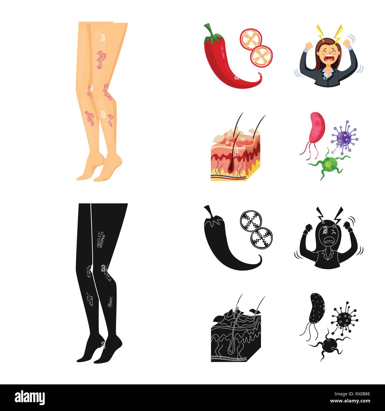 Psoriasis Pepper Stress Skin Bacteria Body Chili Shock Epidermis Virus