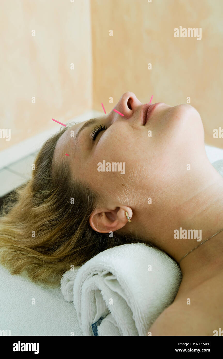 Acupuncture needles face hi-res stock photography and images - Alamy