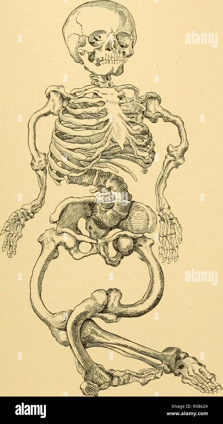 The effects of inanition and The effects of inanition and malnutrition ...