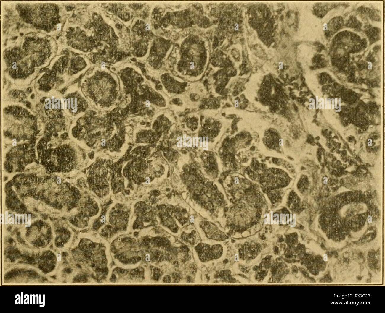 Submaxillary gland hi-res stock photography and images - Alamy