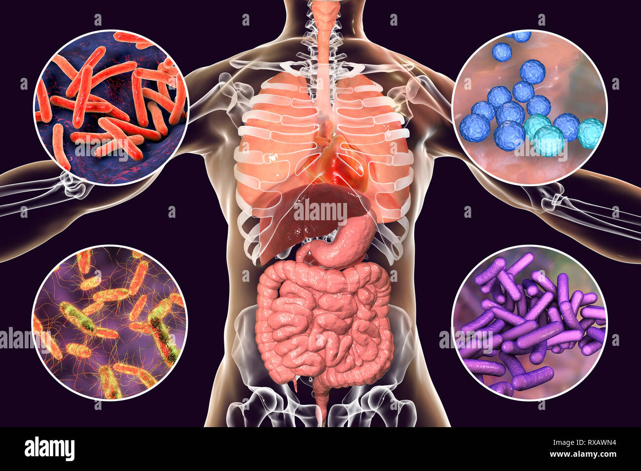 Bacteria that cause human infections, illustration Stock Photo - Alamy