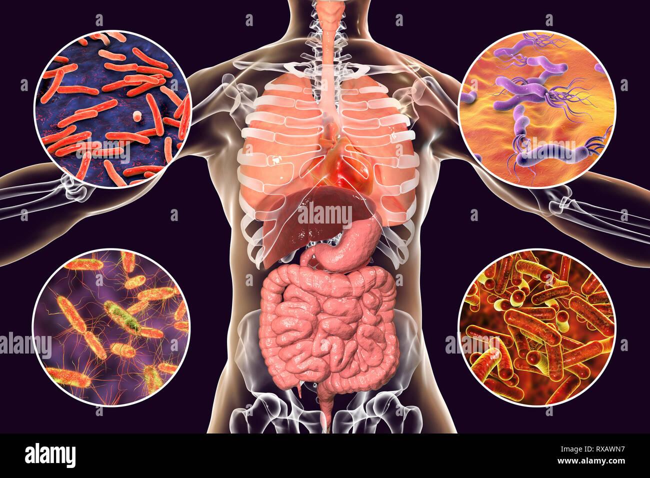 Human Salmonella Infections High Resolution Stock Photography and ...