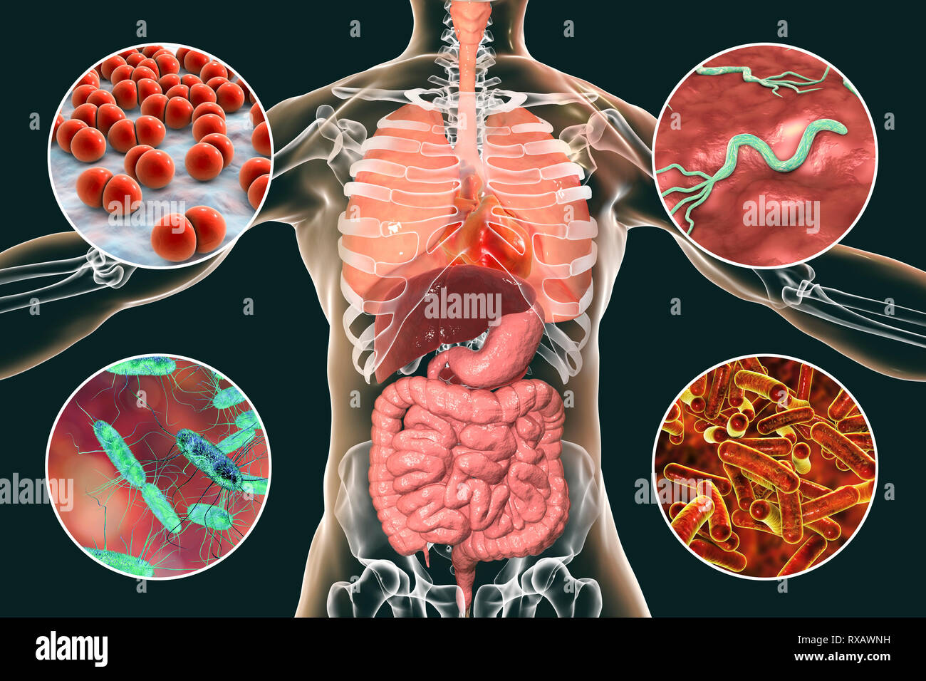 Bacteria that cause human infections, illustration Stock Photo - Alamy