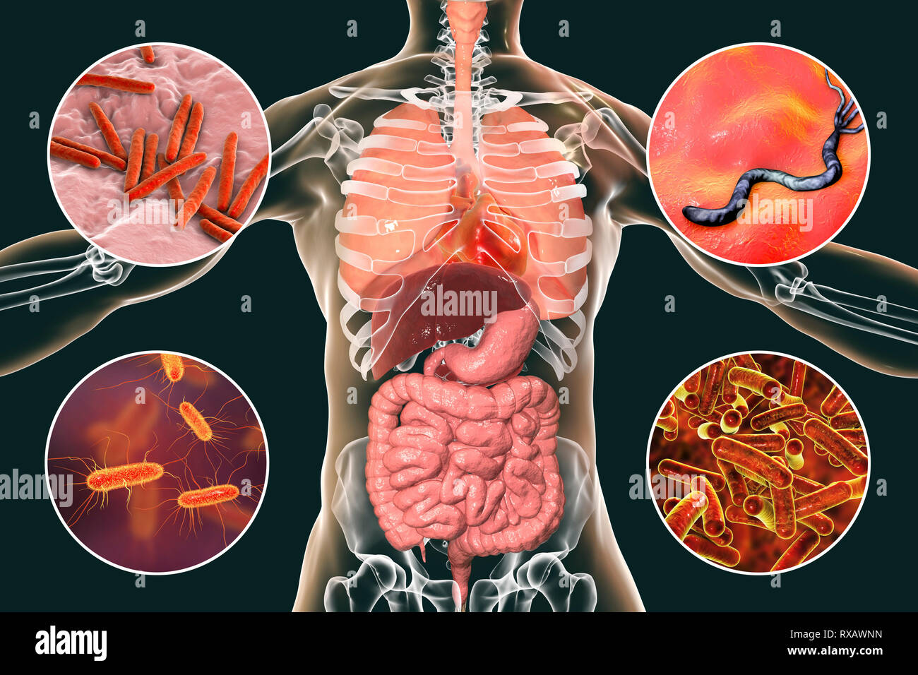Bacteria that cause human infections, illustration Stock Photo - Alamy