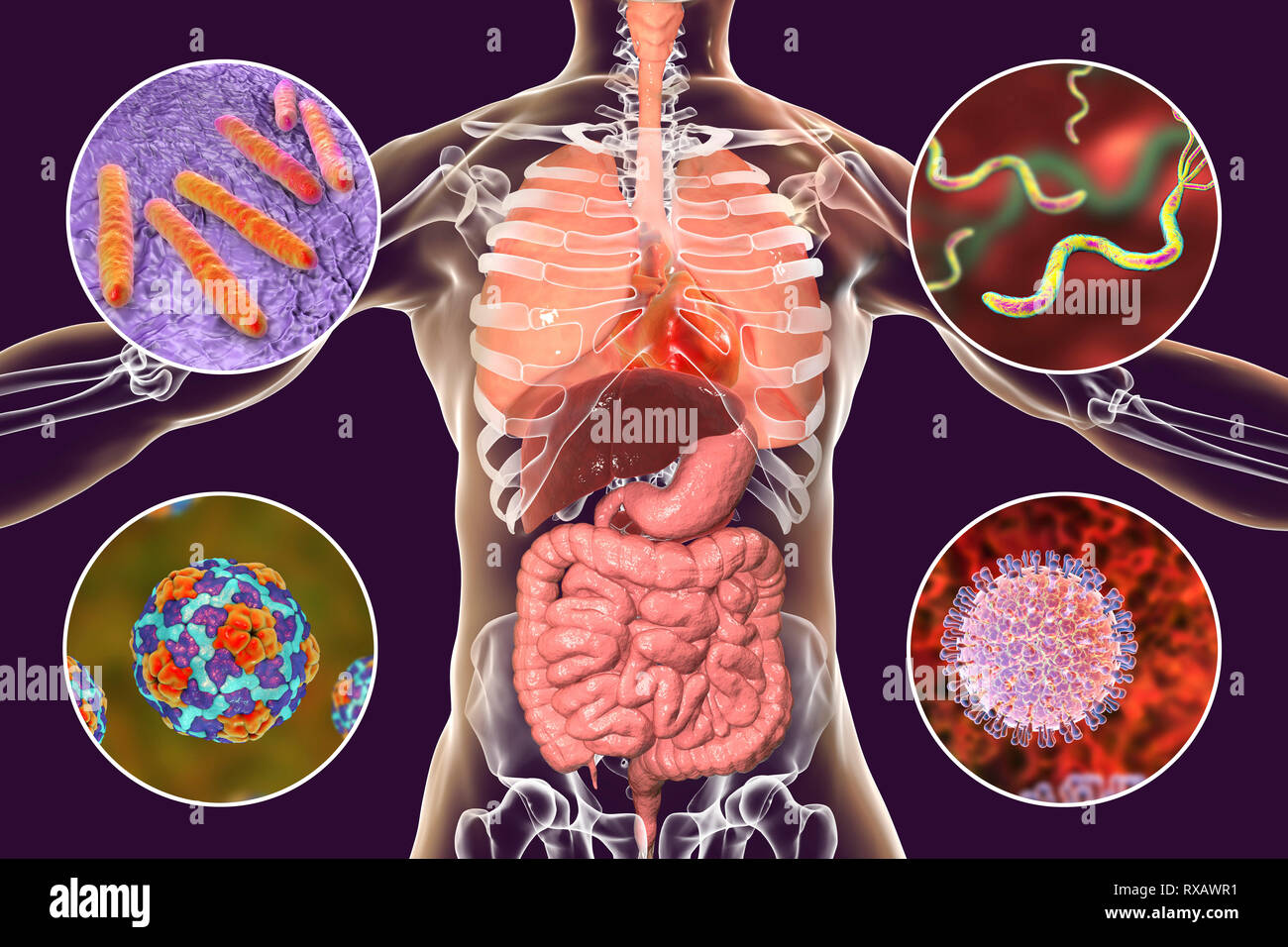 Bacteria that cause human infections, illustration Stock Photo - Alamy