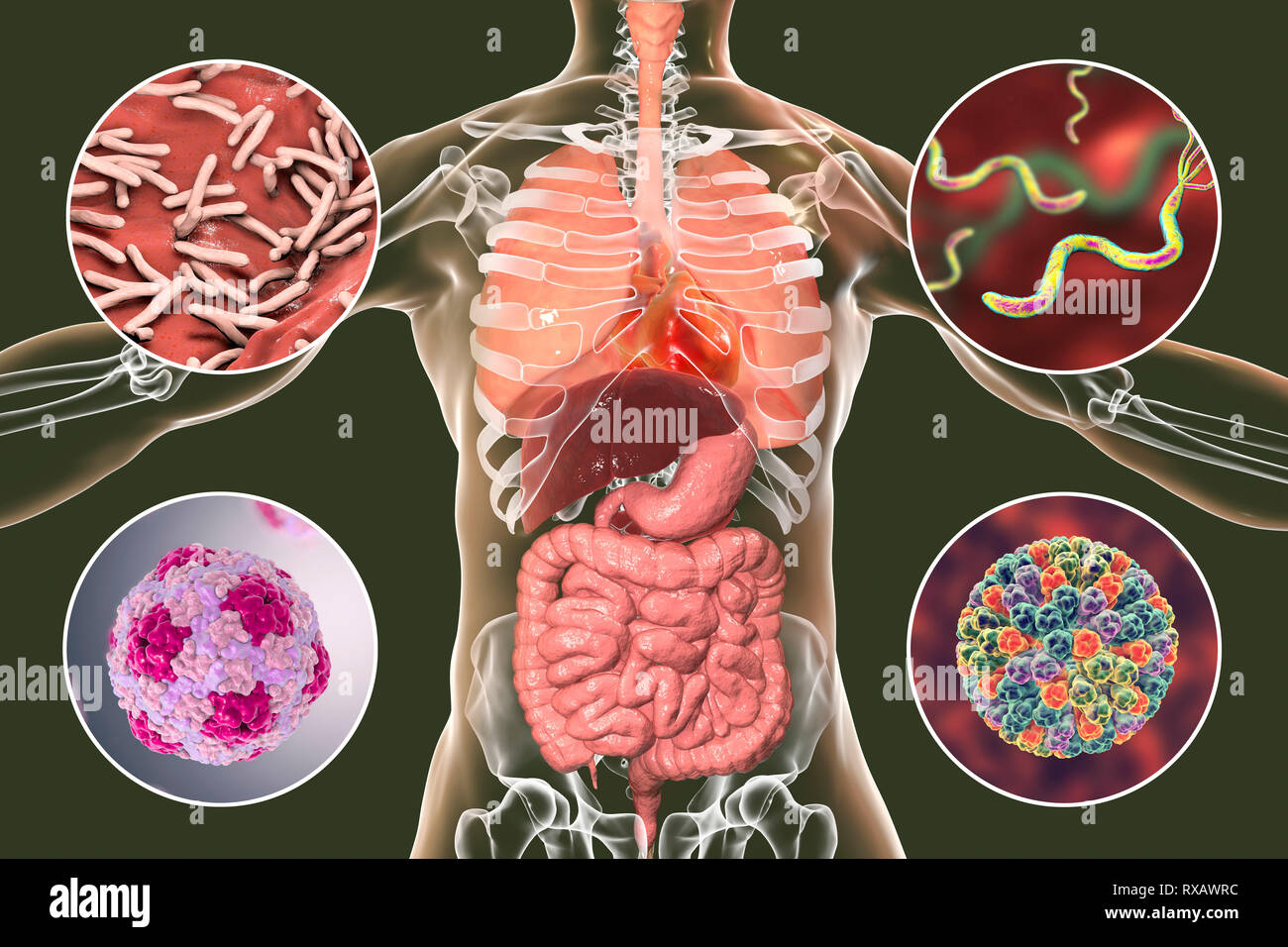 Bacteria that cause human infections, illustration Stock Photo - Alamy