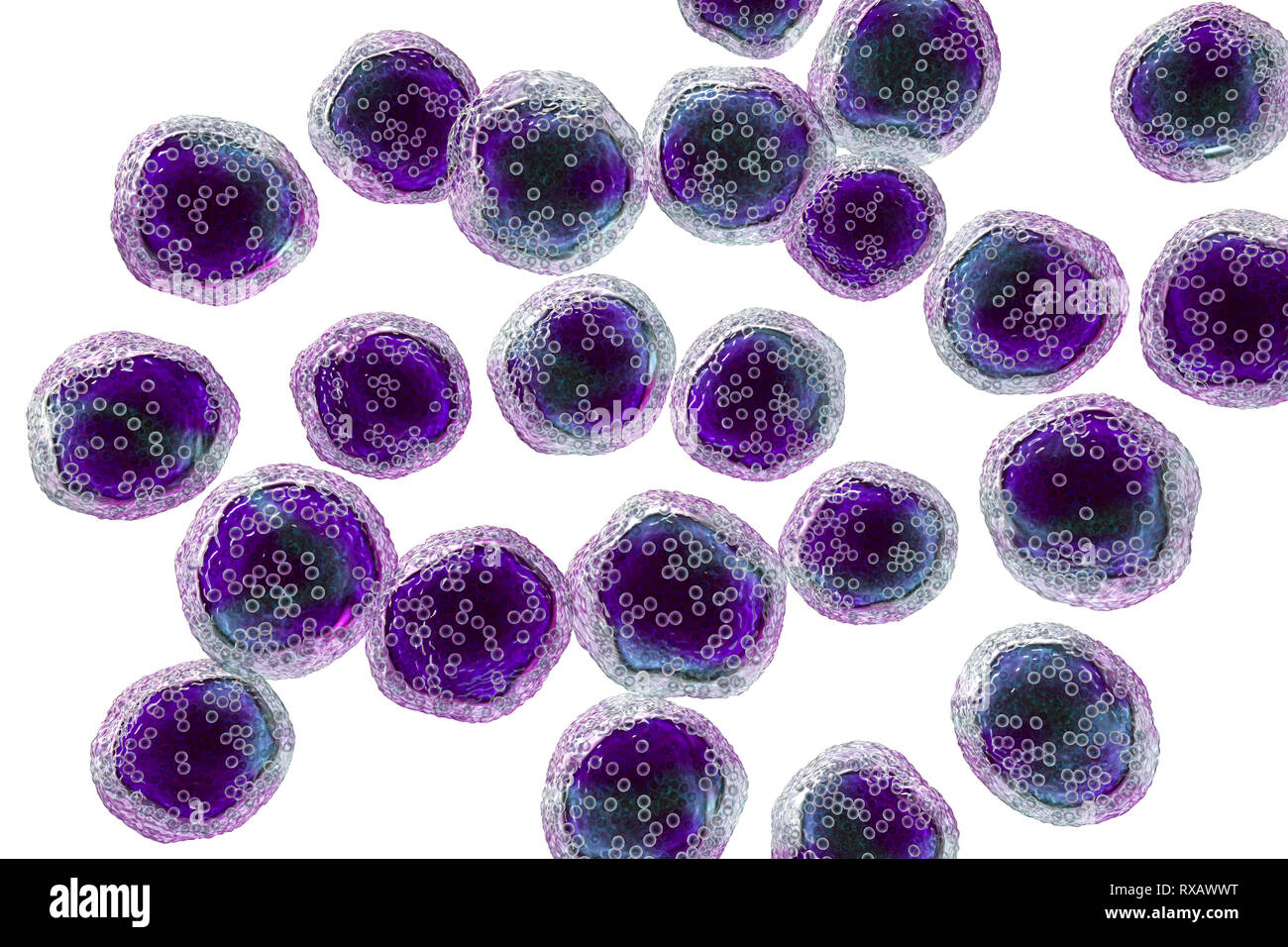 Lymphoma hi-res stock photography and images - Alamy