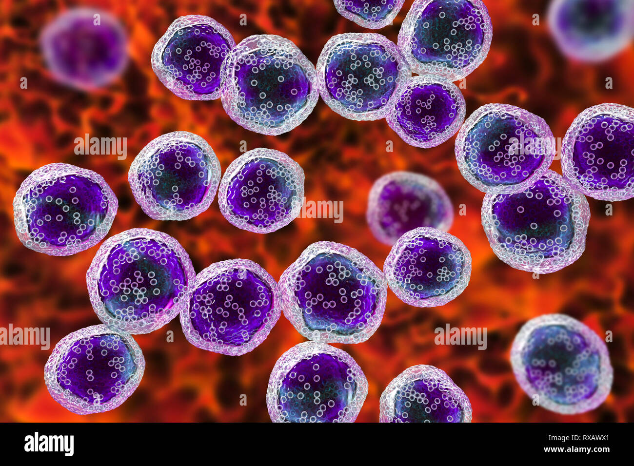 Burkitt's lymphoma cell hi-res stock photography and images - Alamy