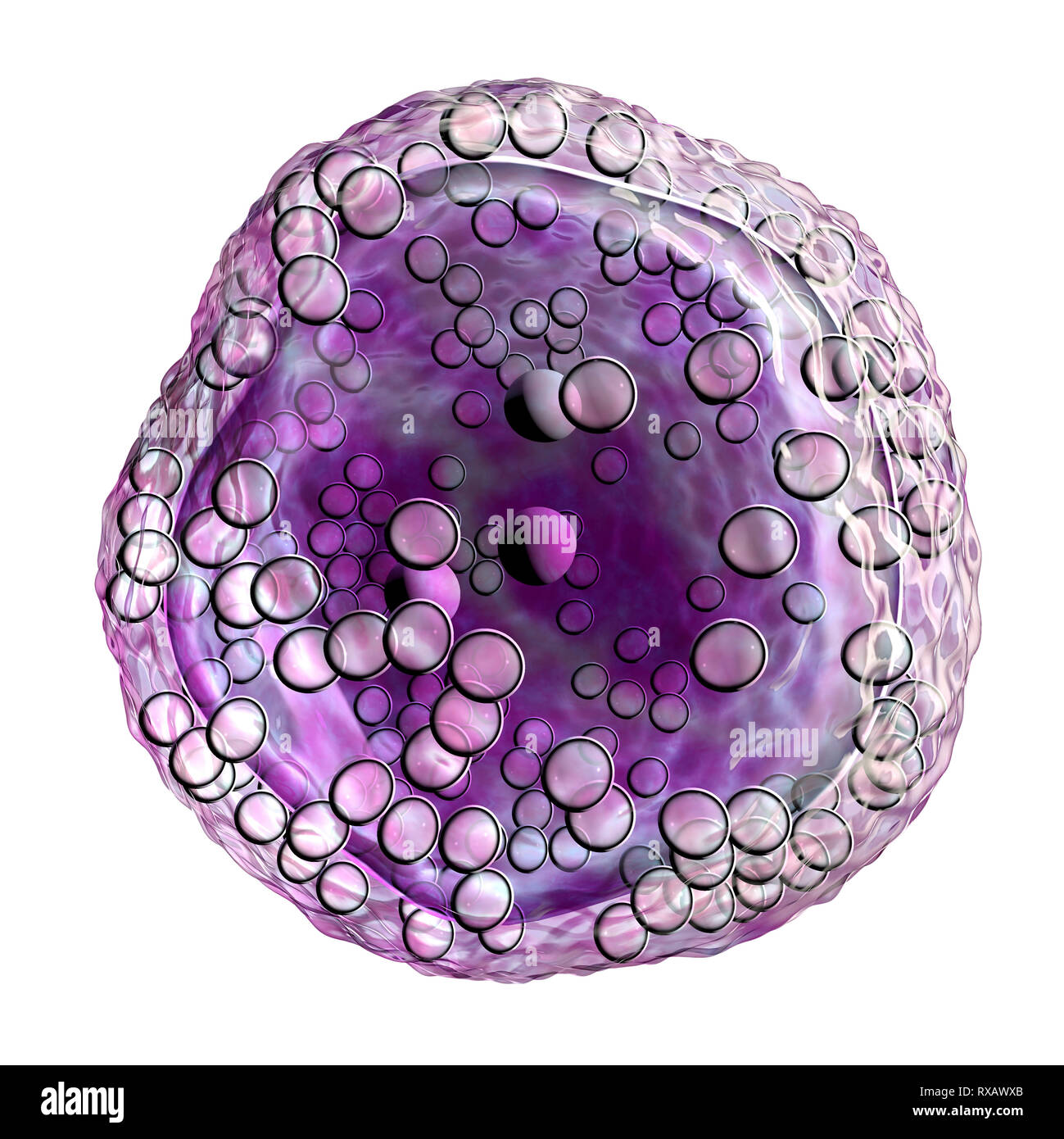 Burkitt's lymphoma cells, illustration Stock Photo - Alamy