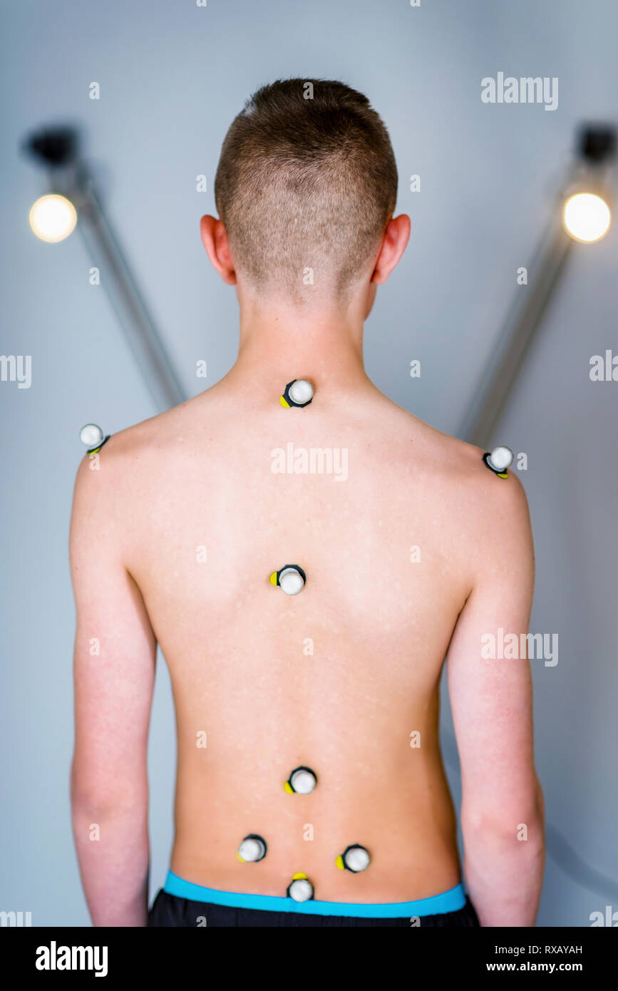 Markers for posture analysis Stock Photo - Alamy
