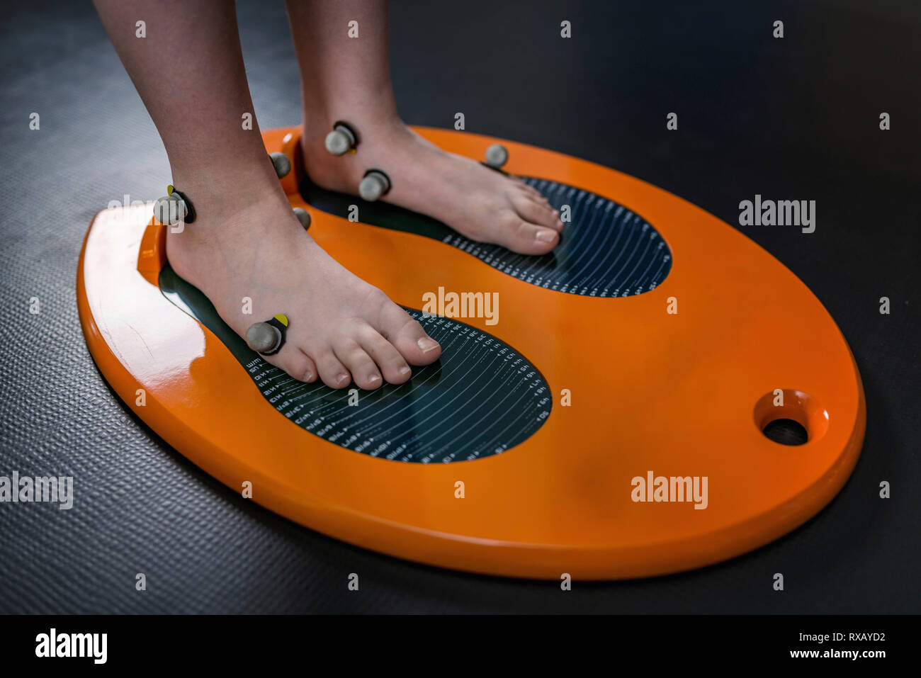 Club foot anatomy hi-res stock photography and images - Alamy