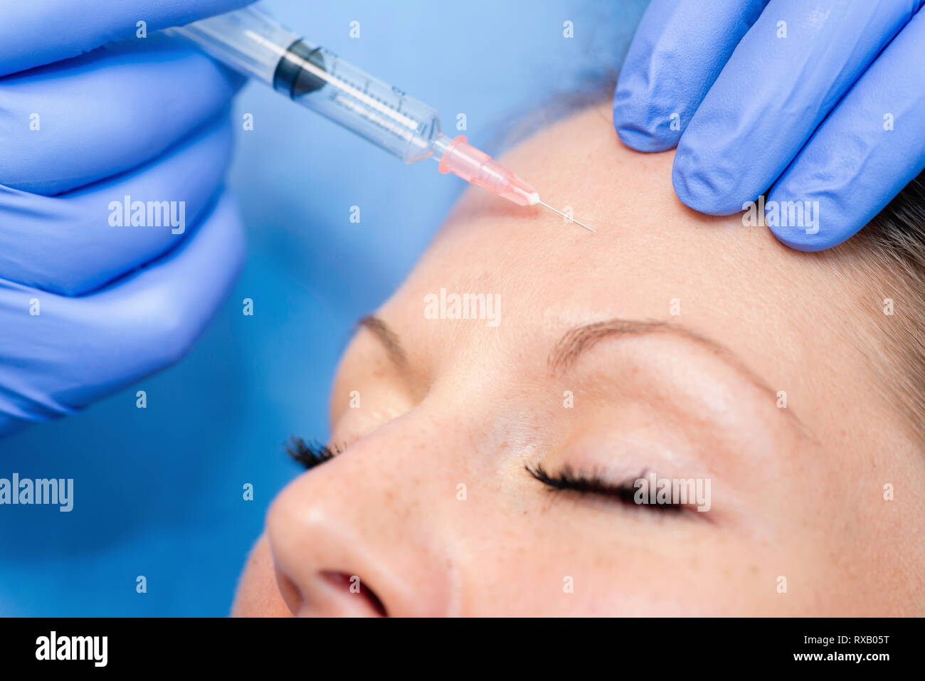 Side view cosmetic botox hi-res stock photography and images - Alamy