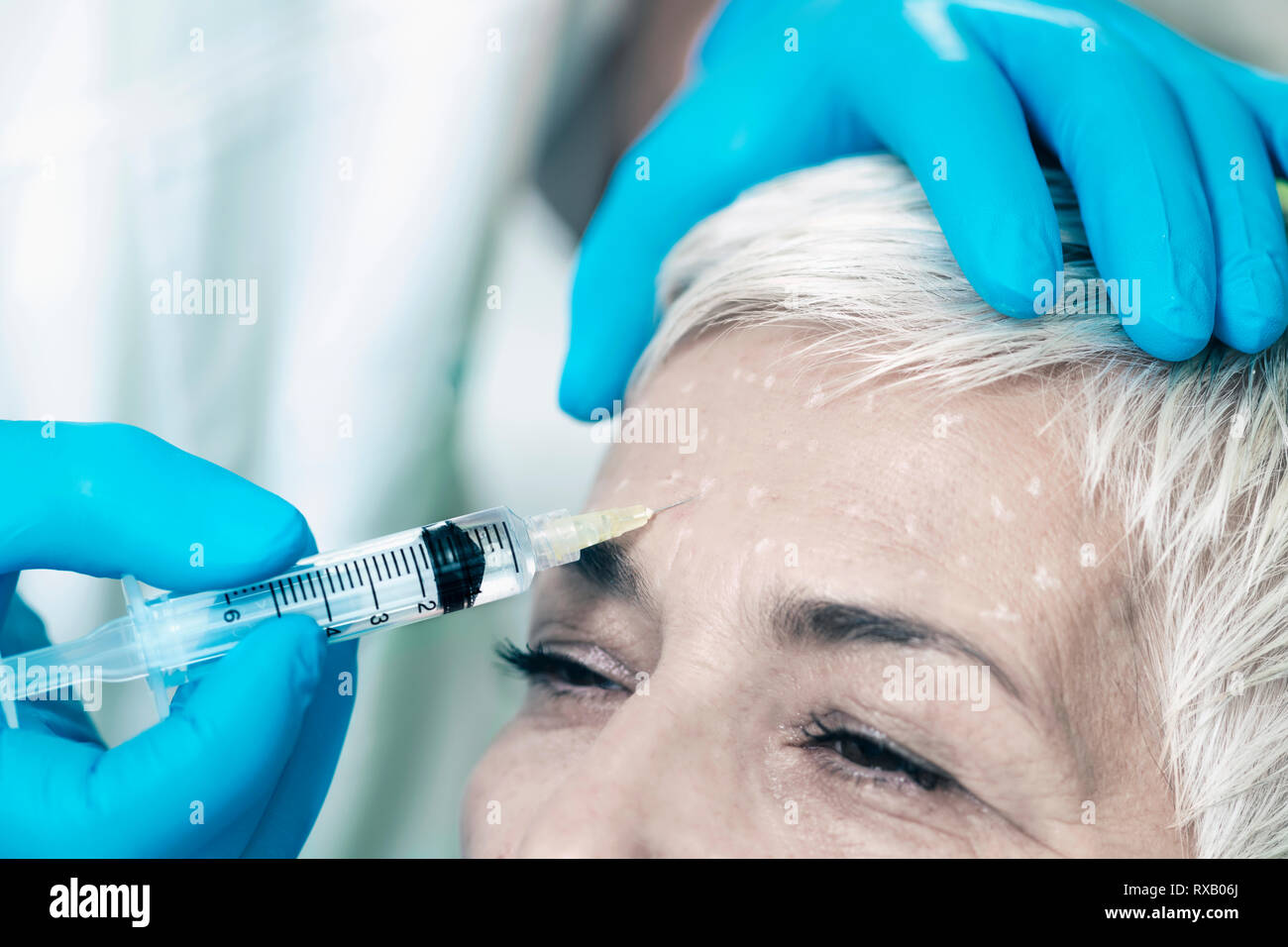 Botulinum toxin injection hi-res stock photography and images - Alamy