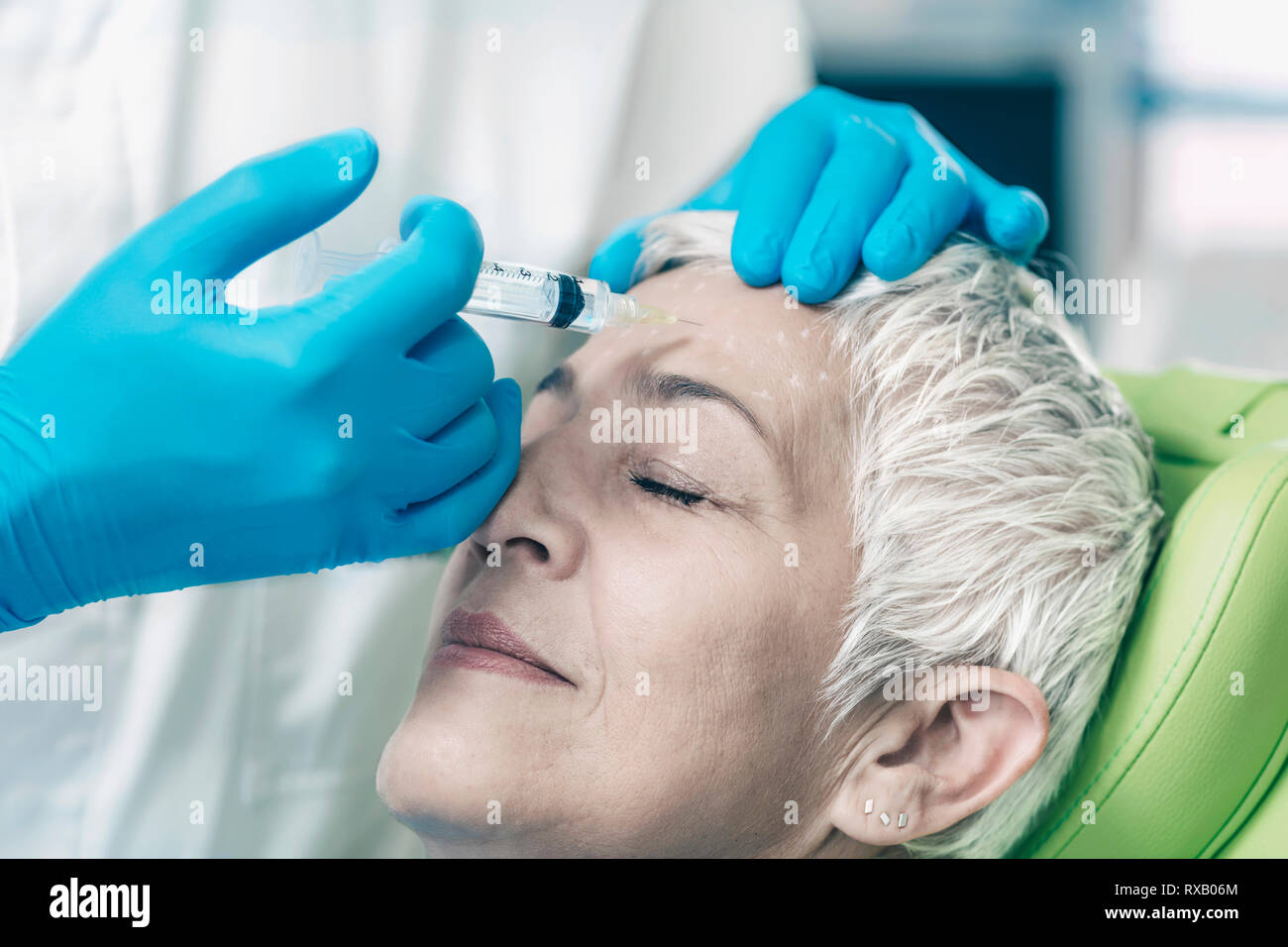 Botulinum toxin injection hi-res stock photography and images - Alamy