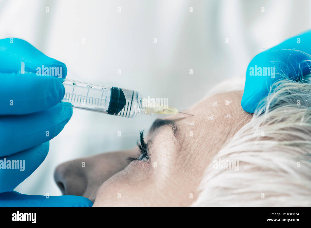 Botulinum toxin injection hi-res stock photography and images - Alamy