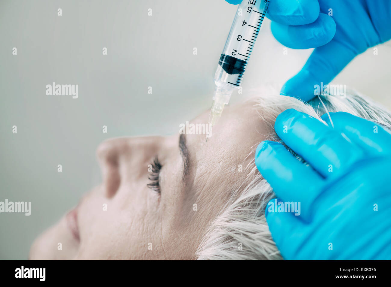 Botulinum Toxin Injection Stock Photos & Botulinum Toxin Injection ...