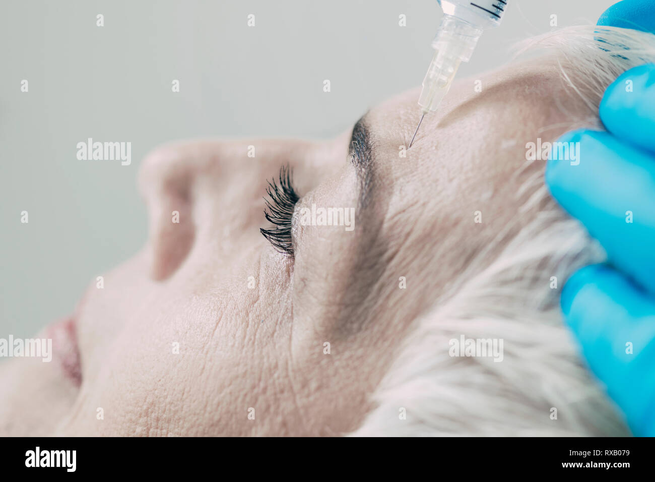 Botox injections hi-res stock photography and images - Alamy