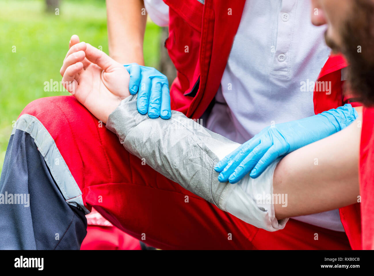 Burn arm hi-res stock photography and images - Alamy
