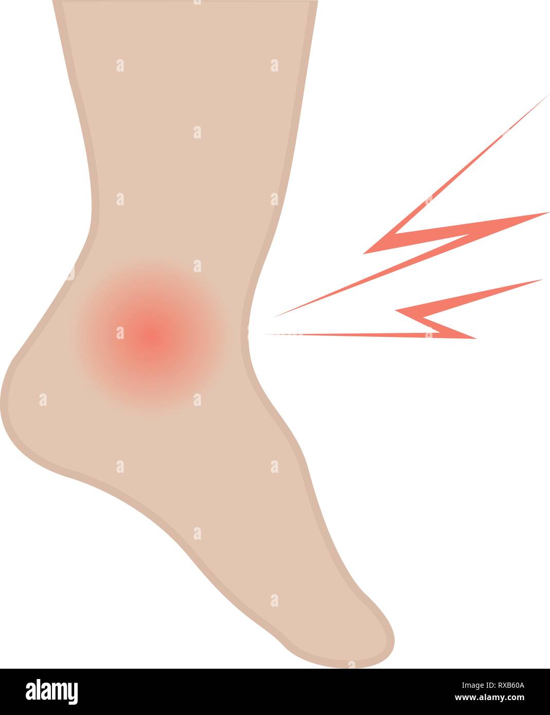 Feet And Ankles Were Swollen at Alfred Wilford blog