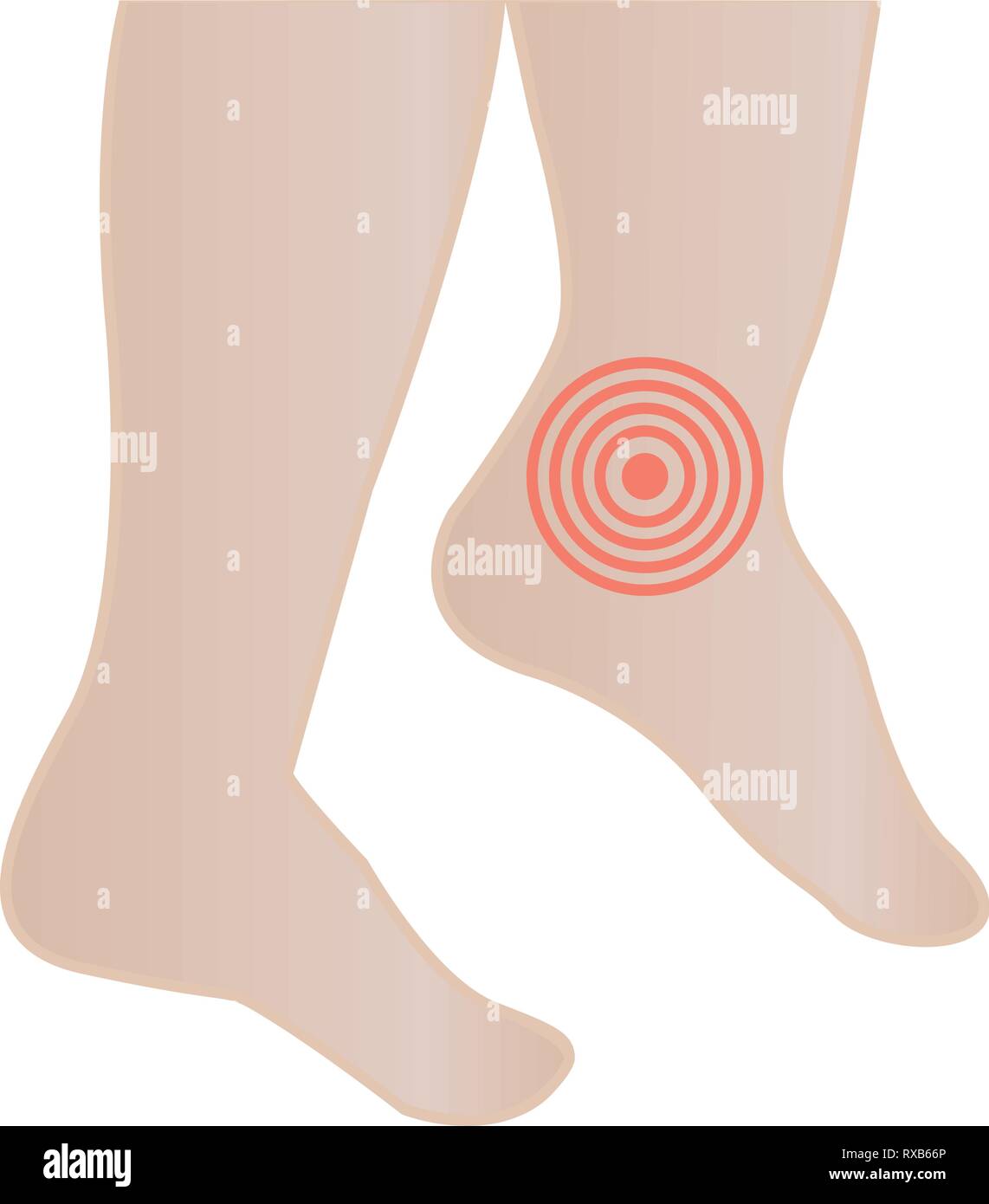 Aching feet Stock Vector Images - Alamy