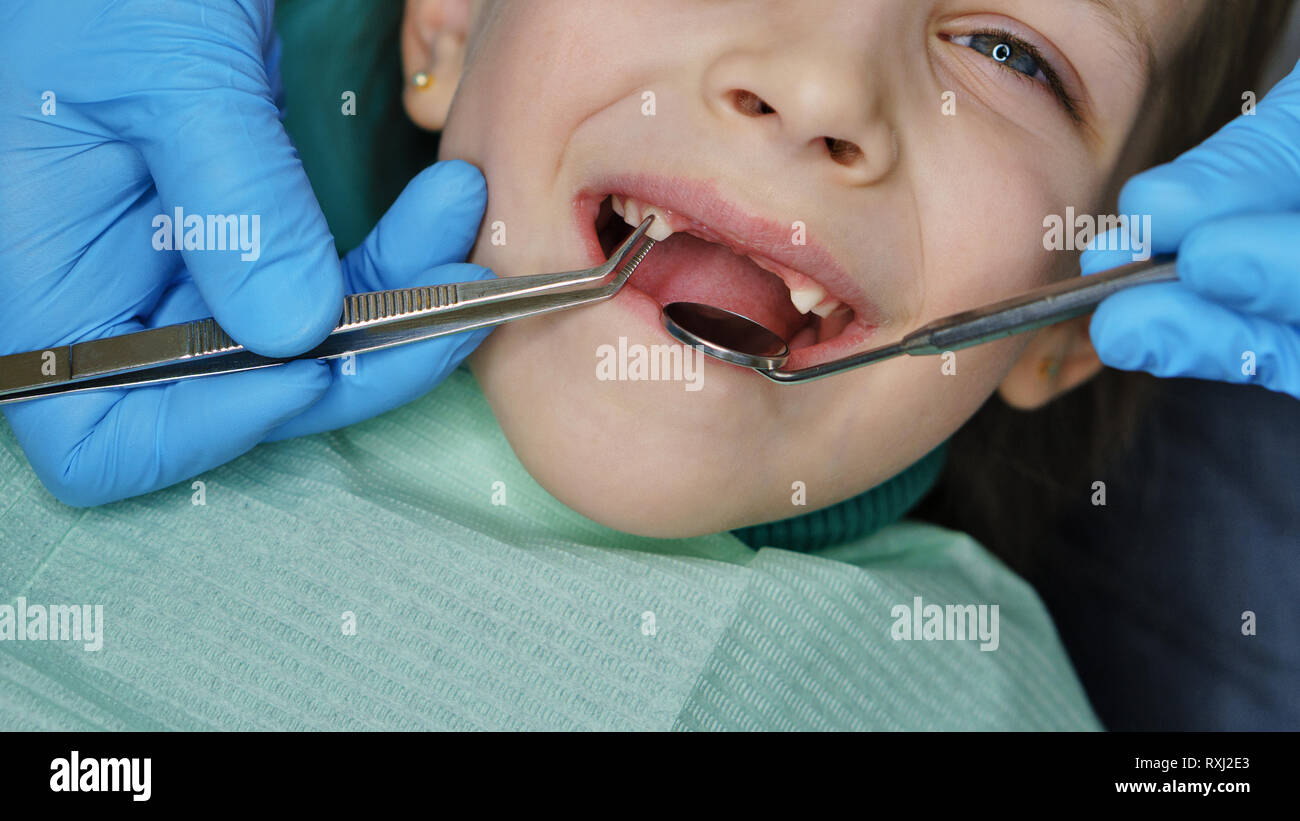 Little girl on examination at dentist. She opened her mouth wide ...
