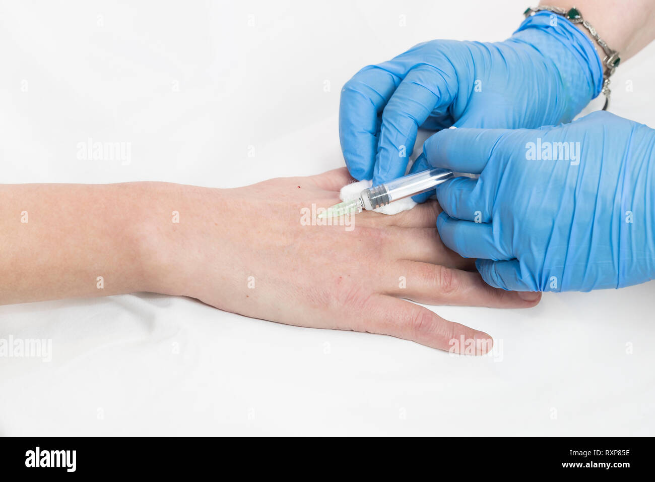 Mesotherapy process on a female hand in clinic Stock Photo - Alamy