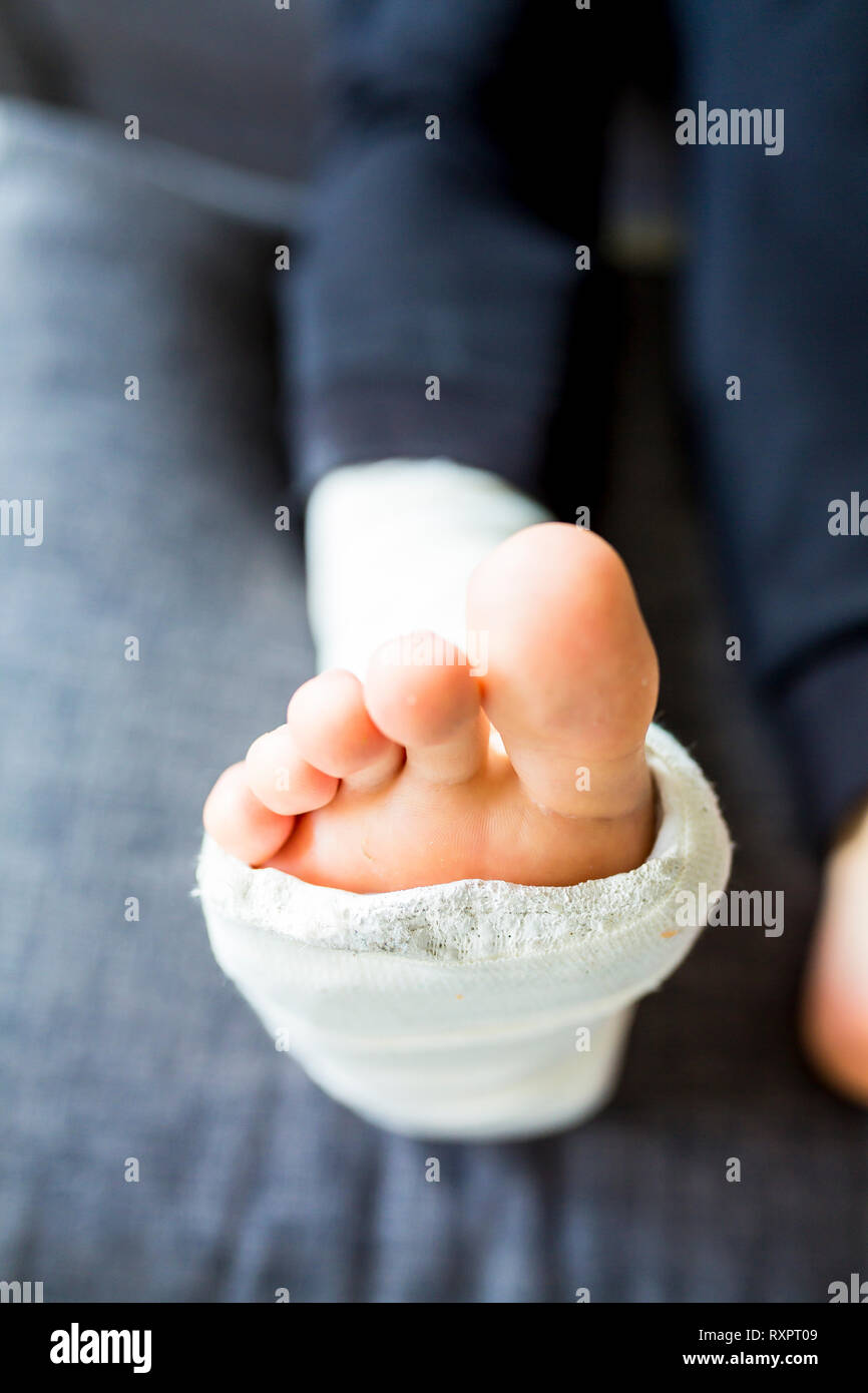 Broken bones hi-res stock photography and images - Alamy