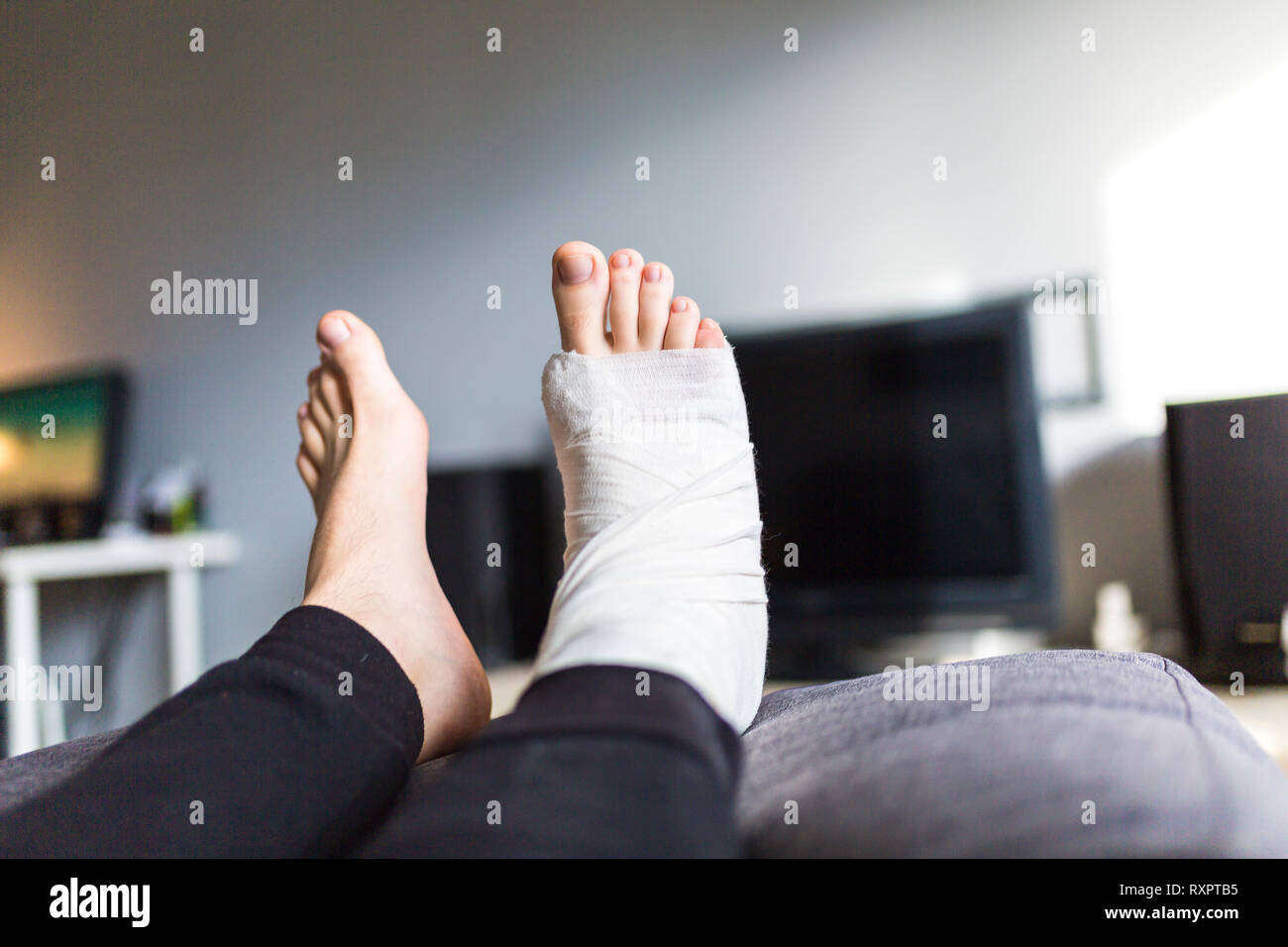 Resting with a broken leg at home Stock Photo - Alamy