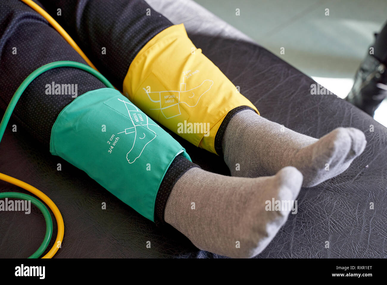 Peripheral artery disease measuring for patient ankle-brachial index ...