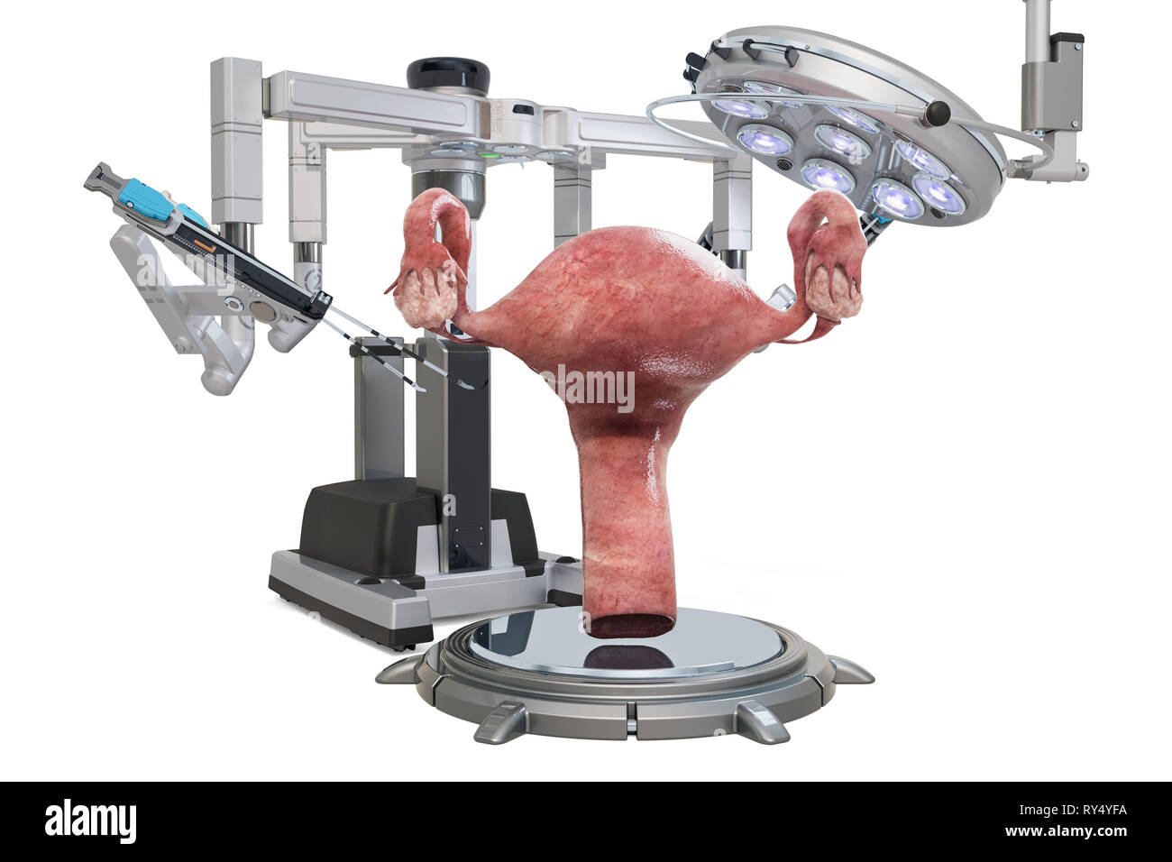 Reproductive surgery Cut Out Stock Images & Pictures - Alamy