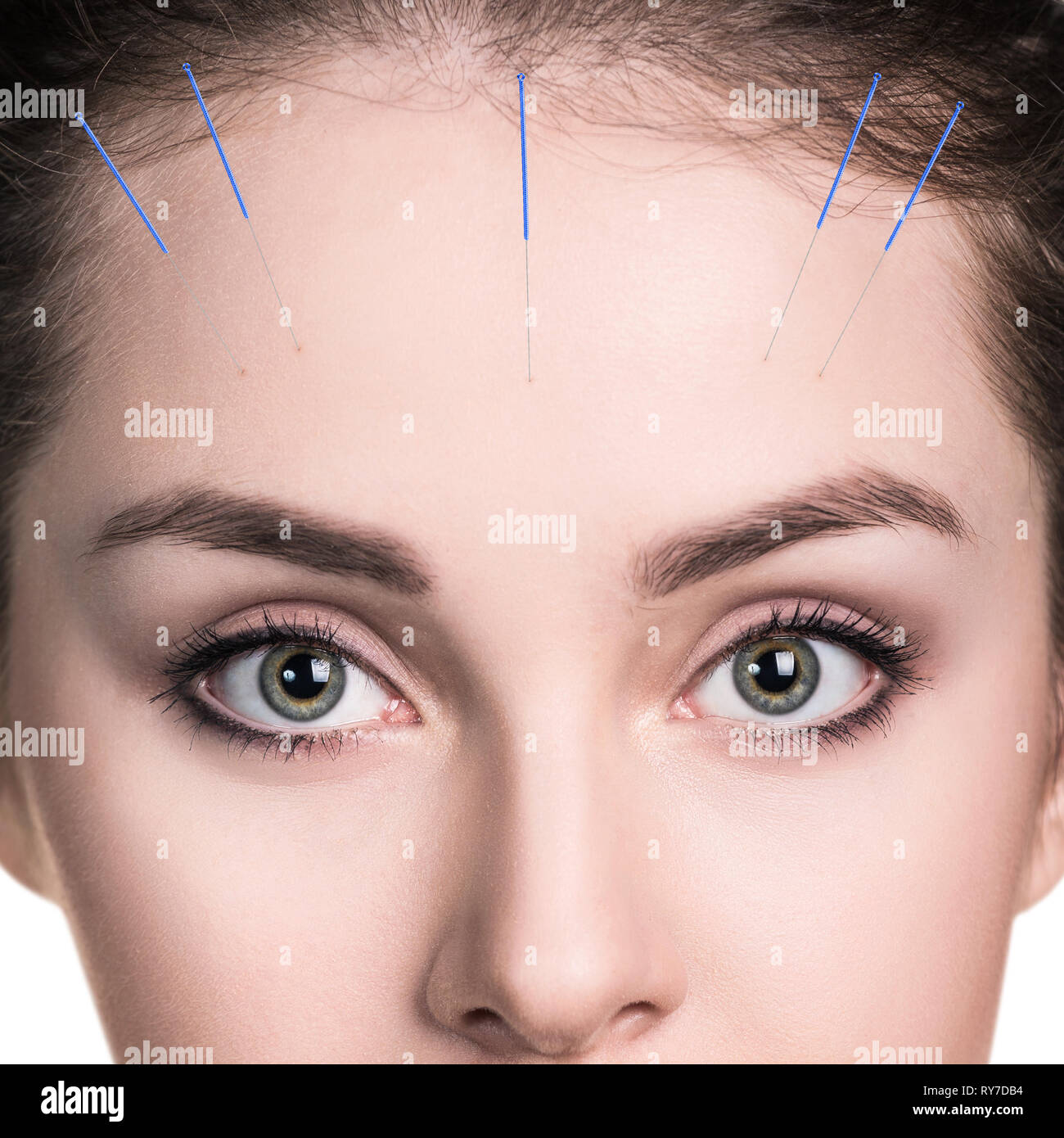 Acupuncture points head hi-res stock photography and images - Alamy
