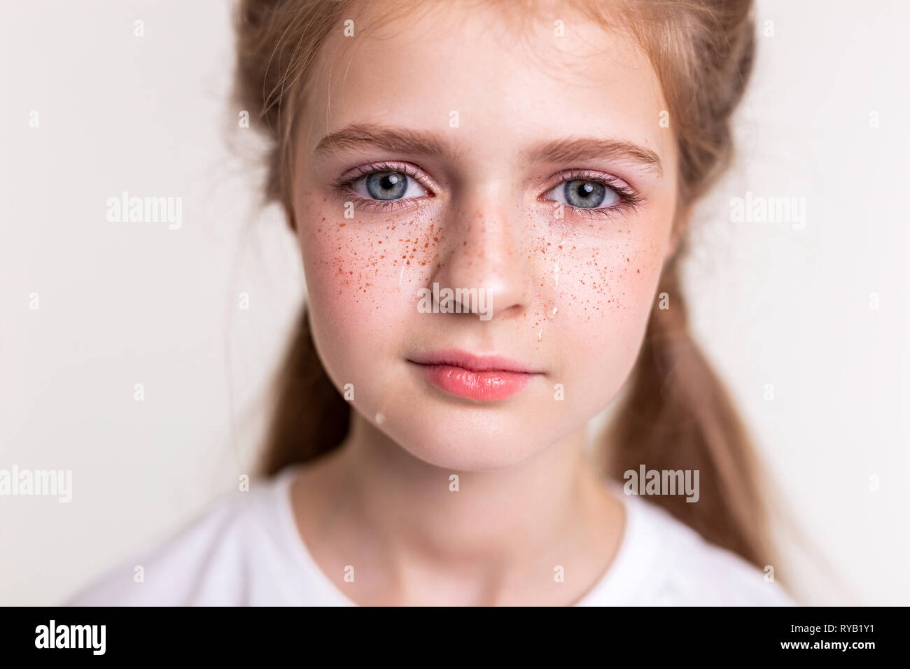 Depressed Eyes
