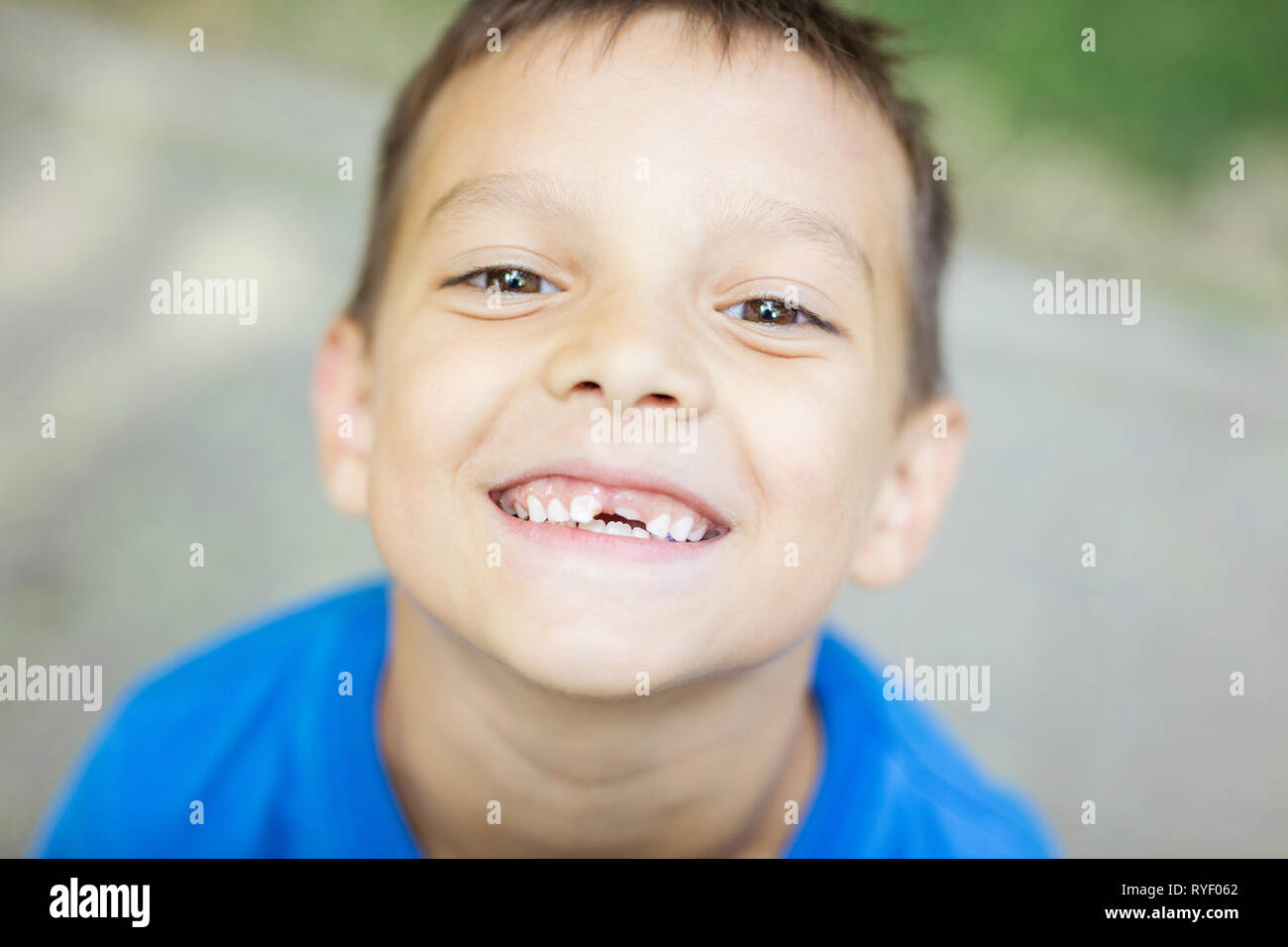 Portrait of young boy smiling and showing his changing baby teeth Stock ...