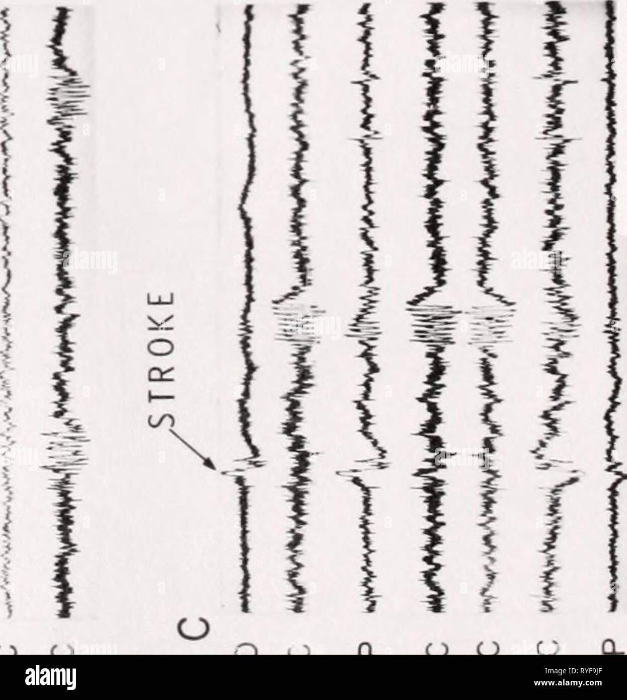 An electroencephalographic and neuroanatomical analysis Stock Photo - Alamy
