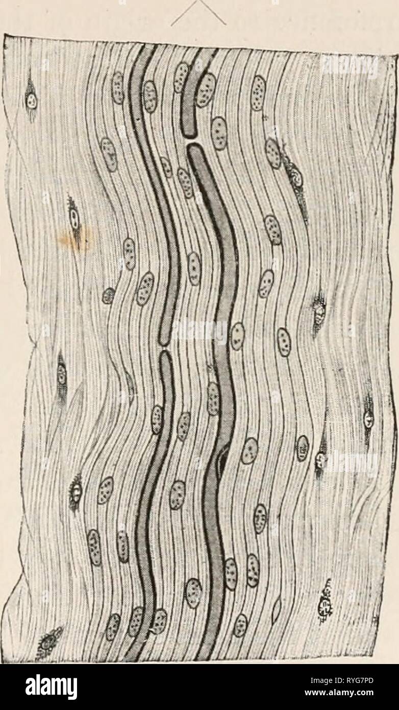 Fibrocartilage Drawing