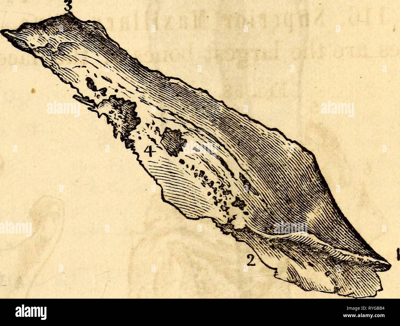 Movable teeth hi-res stock photography and images - Alamy
