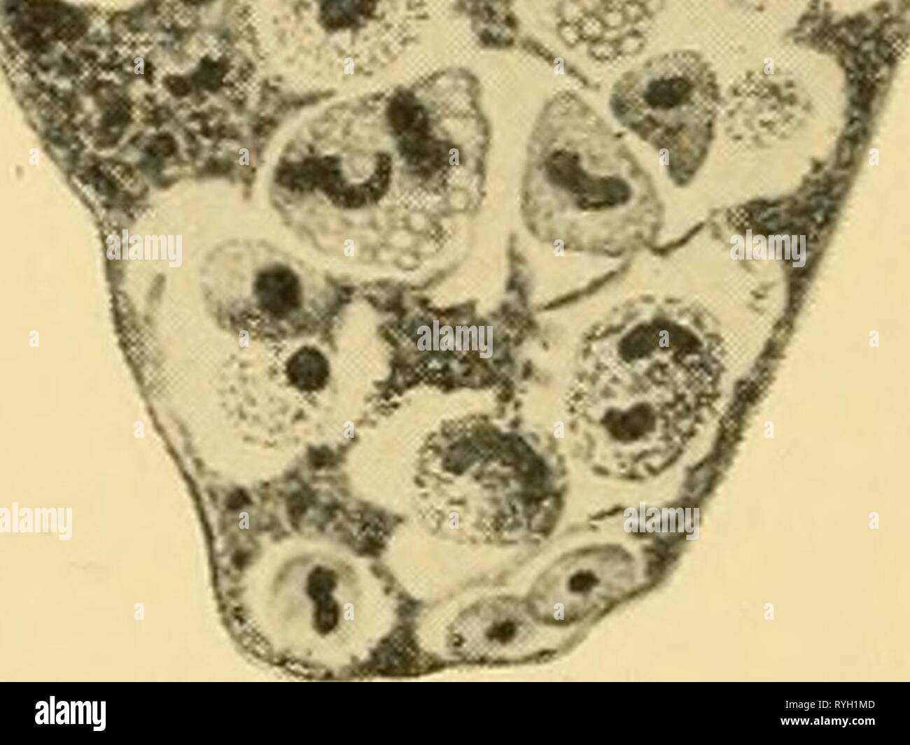 The effects of inanition and Stock Photo - Alamy