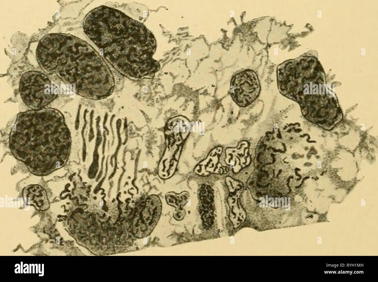 The effects of inanition and Stock Photo - Alamy