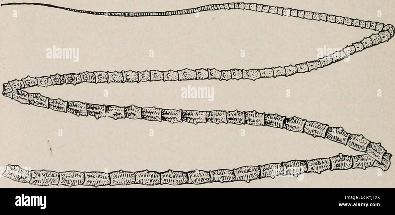 Tape worm brain hi-res stock photography and images - Alamy