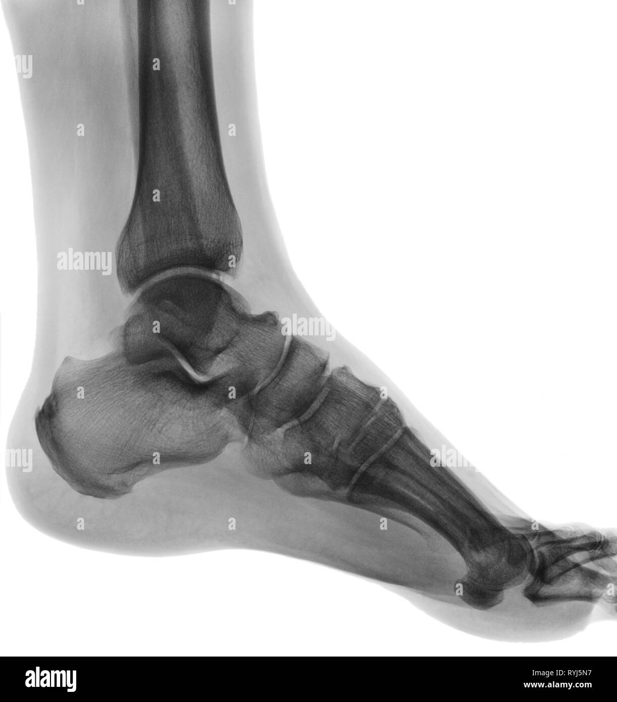 Human foot anatomy Black and White Stock Photos & Images - Alamy