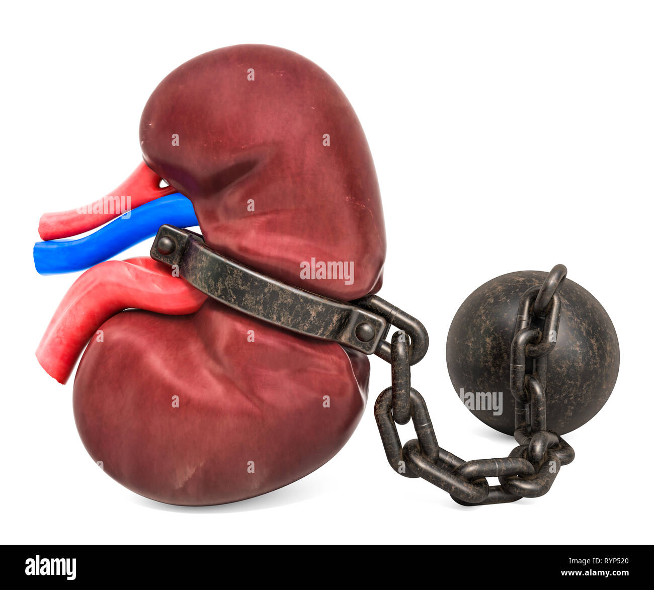 Kidney Pain concept. Human kidney with shackle. 3D rendering isolated ...