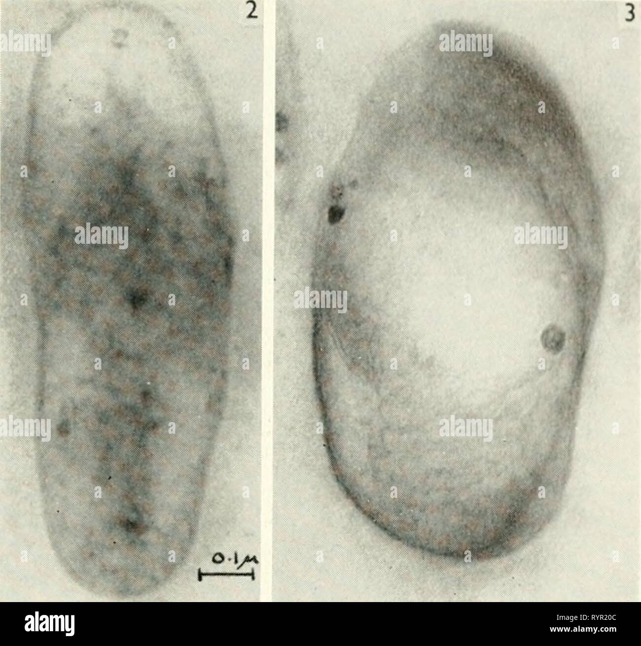 Tubercle bacillus hi-res stock photography and images - Alamy