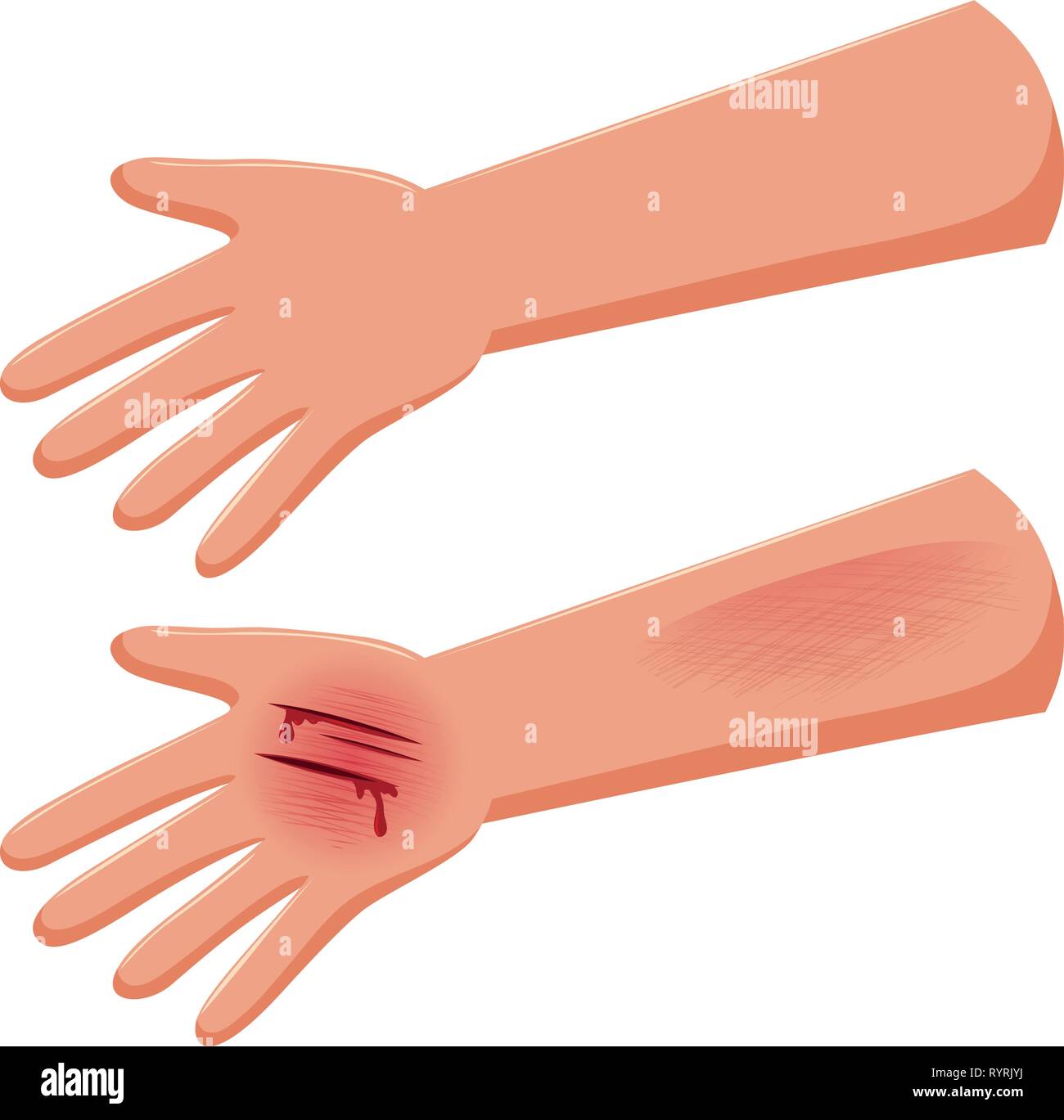 Injure vector vectors hi-res stock photography and images - Alamy