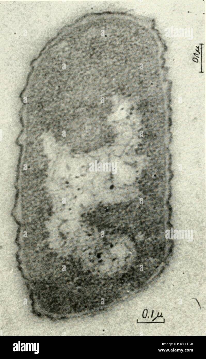 E coli micrograph hi-res stock photography and images - Alamy